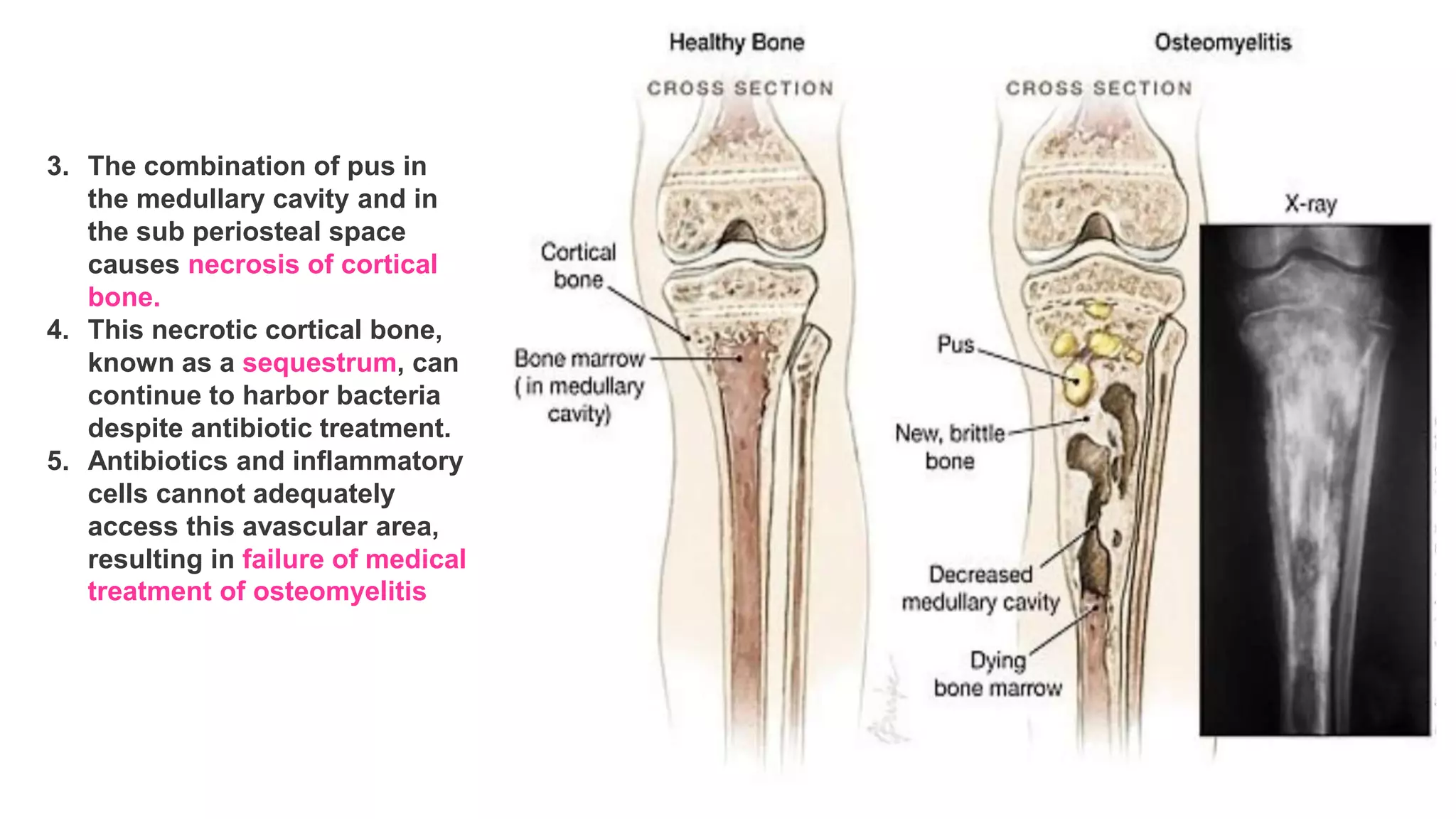mss patho 1 (2).pptx