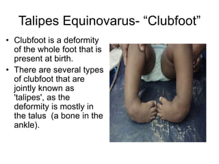 Msu3780 2016 human_body_systems__1._skeletal | PPT