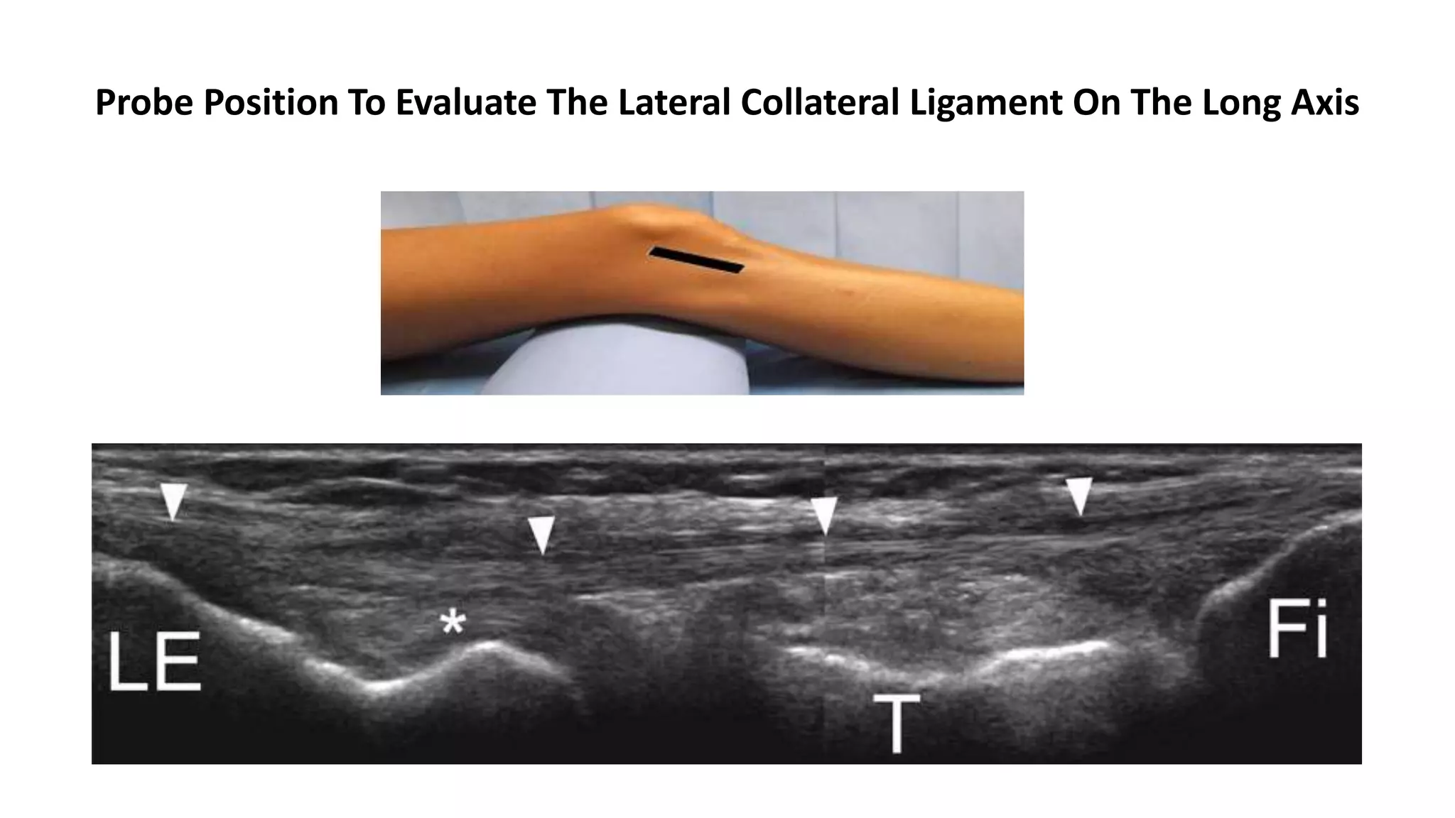 Muscloskeletal Ultrasound of the knee (basic level) | PPTX