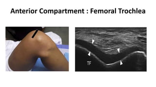 Muscloskeletal Ultrasound of the knee (basic level) | PPTX