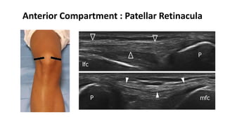 Muscloskeletal Ultrasound of the knee (basic level) | PPTX