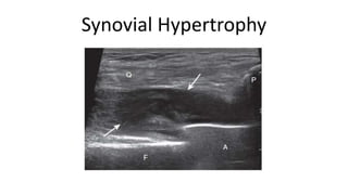 Muscloskeletal Ultrasound of the knee (basic level) | PPTX