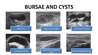 Muscloskeletal Ultrasound of the knee (basic level) | PPTX