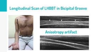 Muscloskeletal Ultrasound of the shoulder (basic level) | PPTX