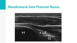 Muscloskeletal Ultrasound of the shoulder (basic level) | PPTX