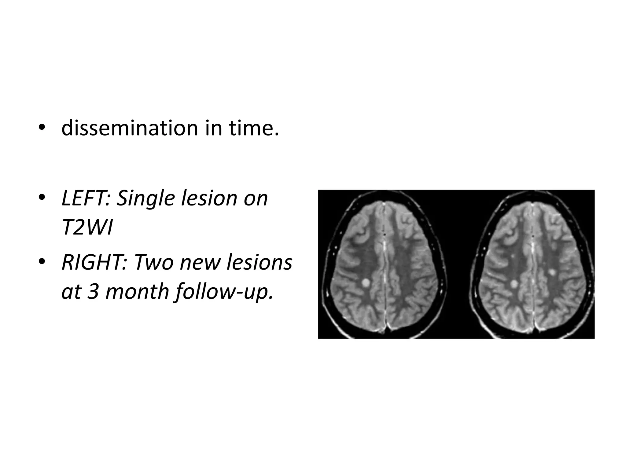 Ms vs adem BASIC DIFFERENCES AND APPROACH | PPTX