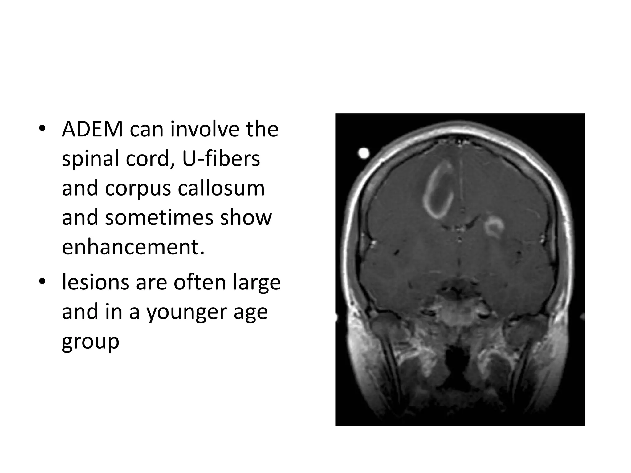 Ms vs adem BASIC DIFFERENCES AND APPROACH | PPTX