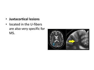 Ms vs adem BASIC DIFFERENCES AND APPROACH | PPTX
