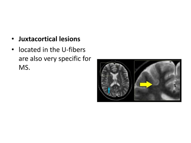 Ms vs adem BASIC DIFFERENCES AND APPROACH | PPTX
