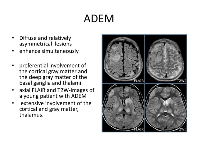 Ms vs adem BASIC DIFFERENCES AND APPROACH | PPTX