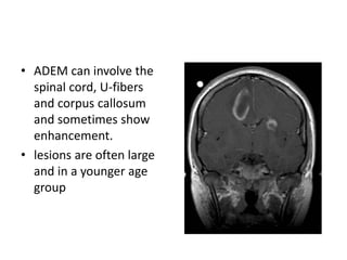 Ms vs adem BASIC DIFFERENCES AND APPROACH | PPTX