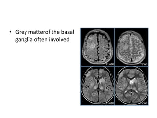 Ms vs adem BASIC DIFFERENCES AND APPROACH | PPTX
