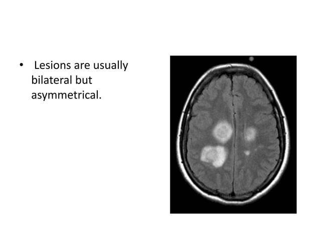 Ms vs adem BASIC DIFFERENCES AND APPROACH | PPTX