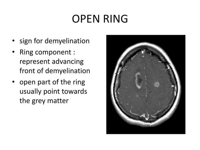 Ms vs adem BASIC DIFFERENCES AND APPROACH | PPTX