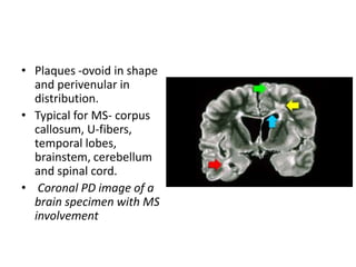 Ms vs adem BASIC DIFFERENCES AND APPROACH | PPTX