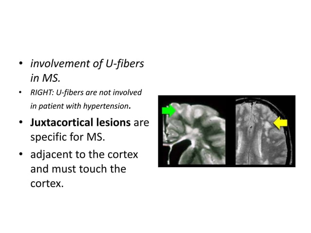 Ms vs adem BASIC DIFFERENCES AND APPROACH | PPTX