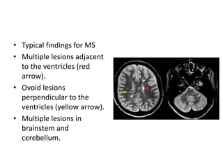 Ms vs adem BASIC DIFFERENCES AND APPROACH | PPTX