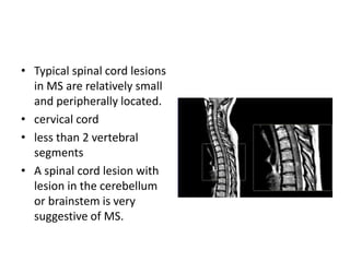 Ms vs adem BASIC DIFFERENCES AND APPROACH | PPTX