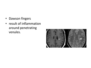 Ms vs adem BASIC DIFFERENCES AND APPROACH | PPTX