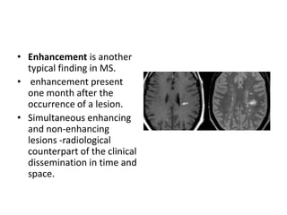 Ms vs adem BASIC DIFFERENCES AND APPROACH | PPTX