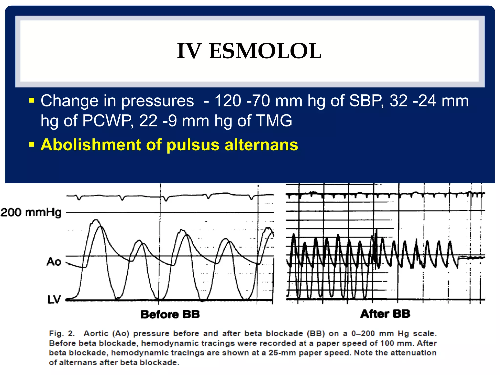 Mitral Stenosis with pulsus alternans | PPT