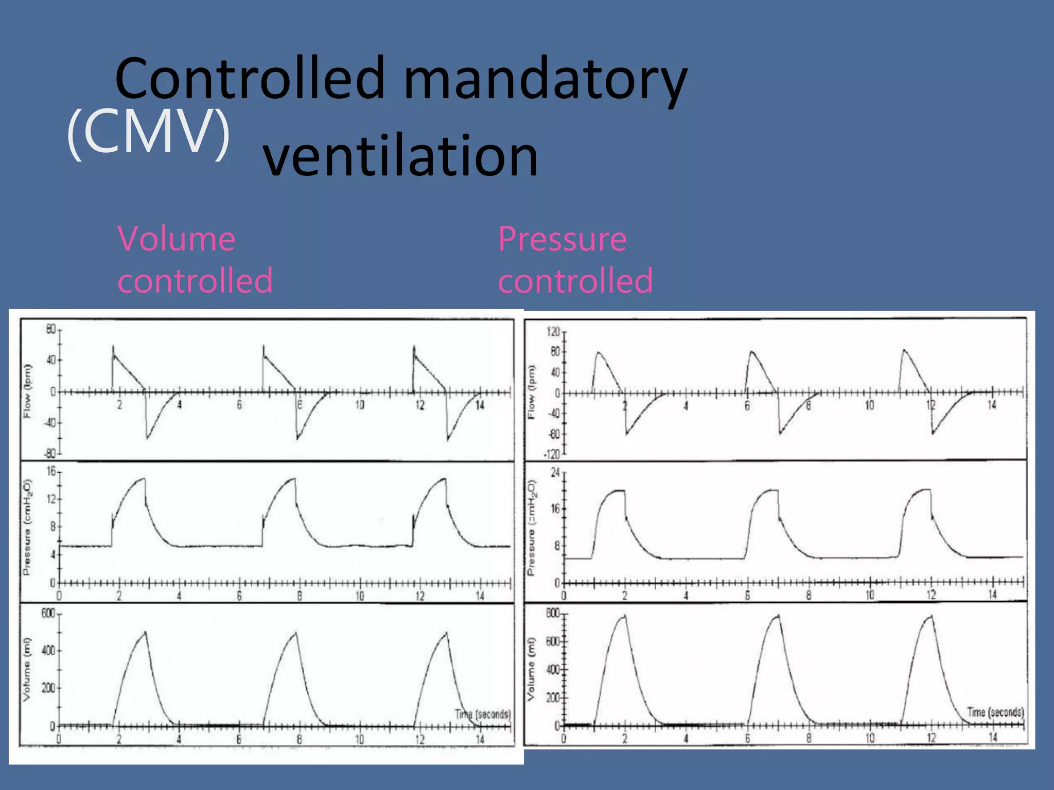 Approach to Mechanical ventilation | PPTX | Lung and Respiratory Health ...