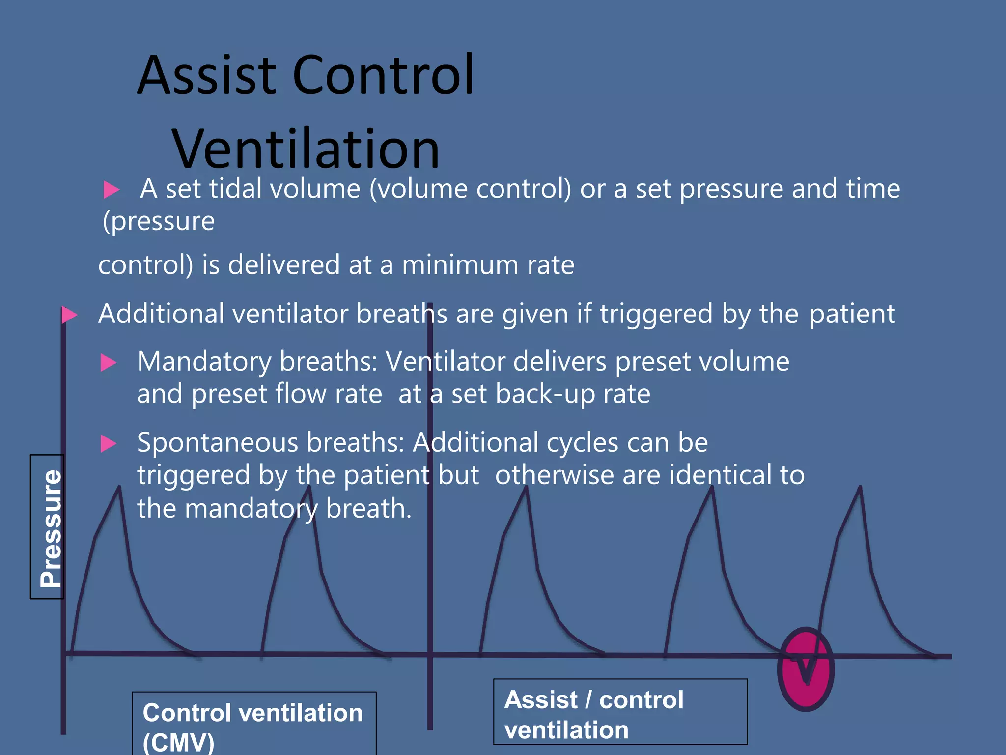 Approach to Mechanical ventilation | PPTX