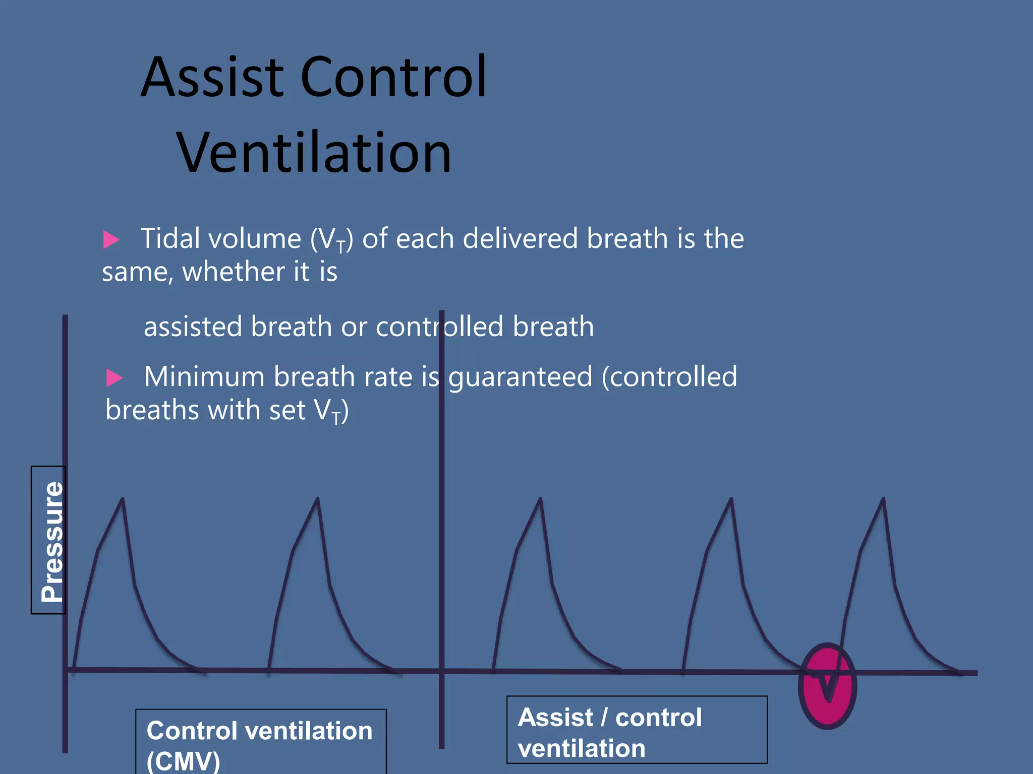 Approach to Mechanical ventilation | PPTX