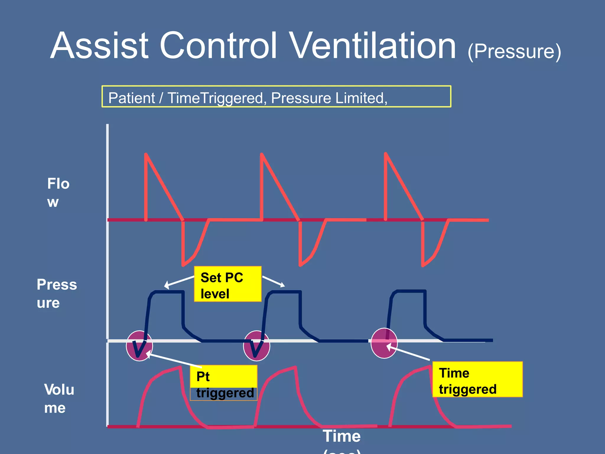 Approach to Mechanical ventilation | PPTX