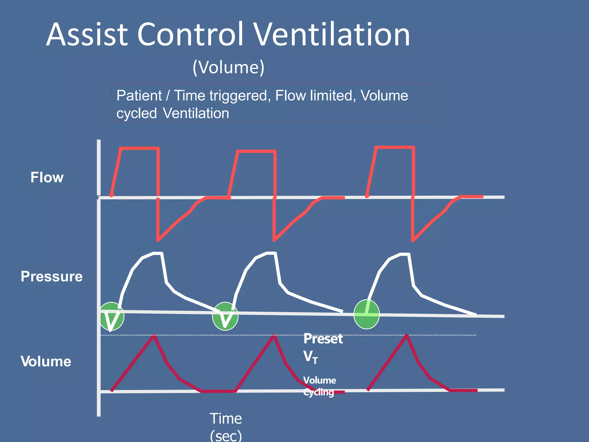 Approach to Mechanical ventilation | PPTX