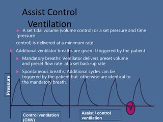 Approach to Mechanical ventilation | PPTX