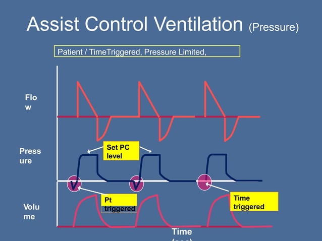 Approach to Mechanical ventilation | PPTX | Lung and Respiratory Health ...