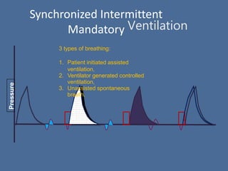 Approach to Mechanical ventilation | PPTX