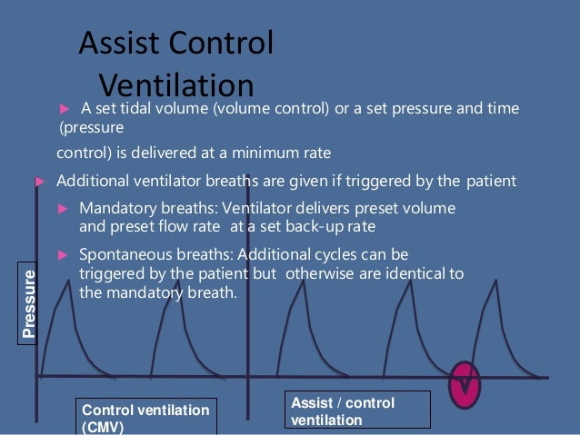 Approach to Mechanical ventilation