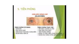 MẮT 1111111111111111111111111111111111111111.pptx