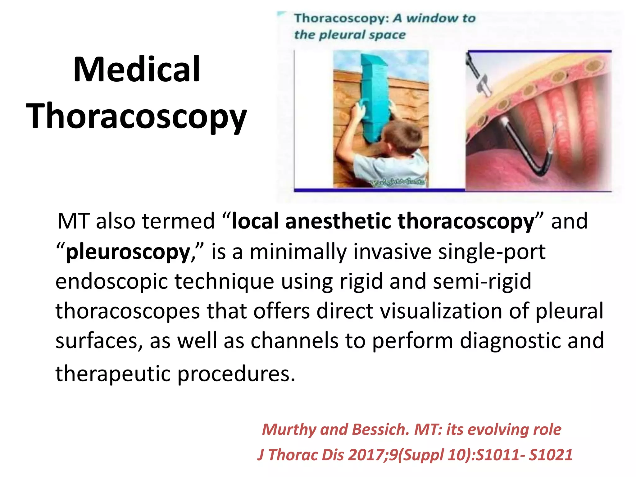 medical thoracoscopy2022 | PPTX