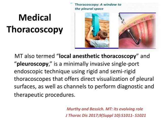 medical thoracoscopy2022 | PPTX