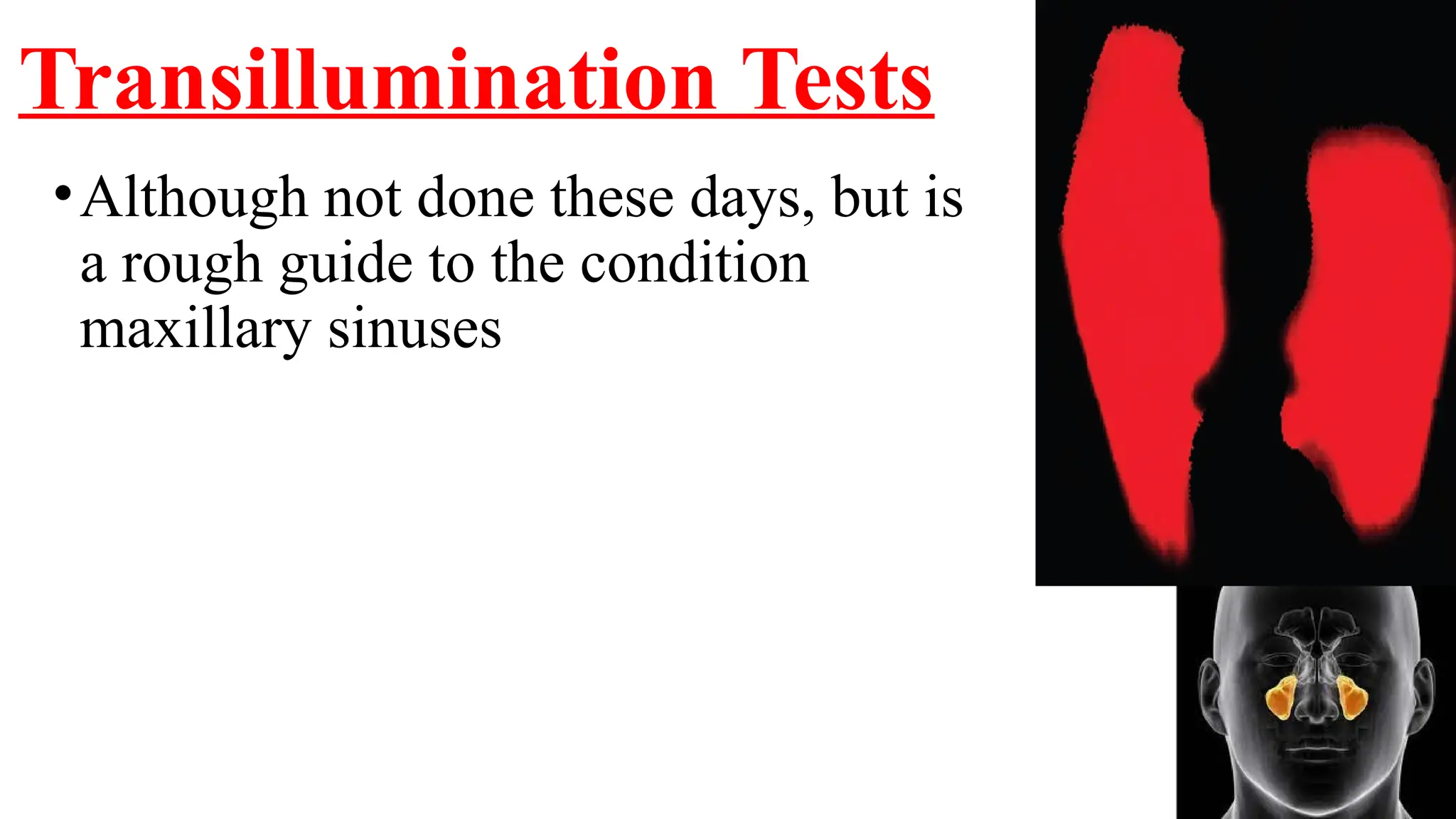 maxillary sinus examination for undergraduates .pptx