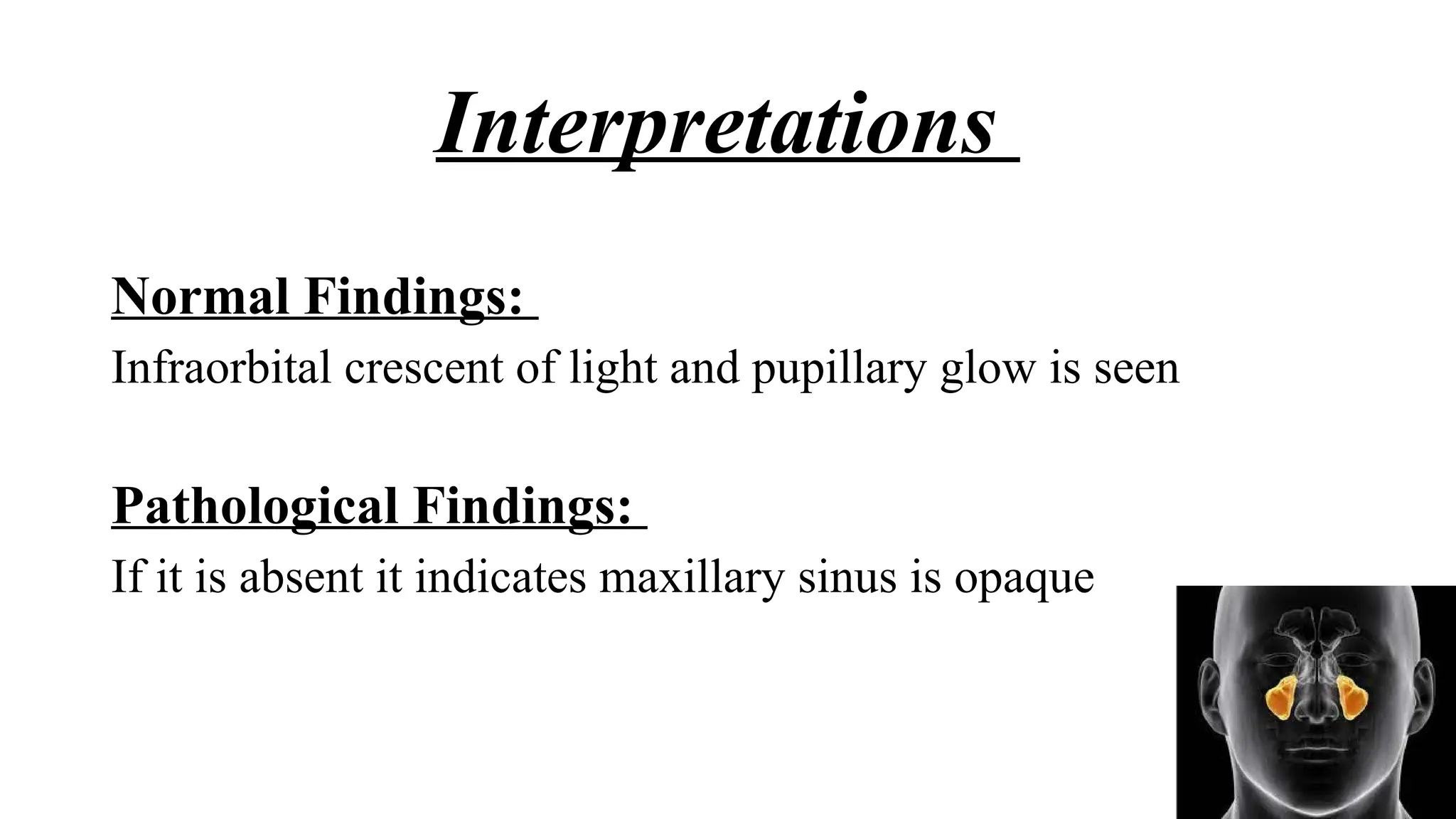 maxillary sinus examination for undergraduates .pptx
