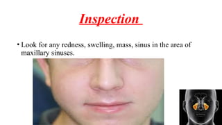 maxillary sinus examination for undergraduates .pptx