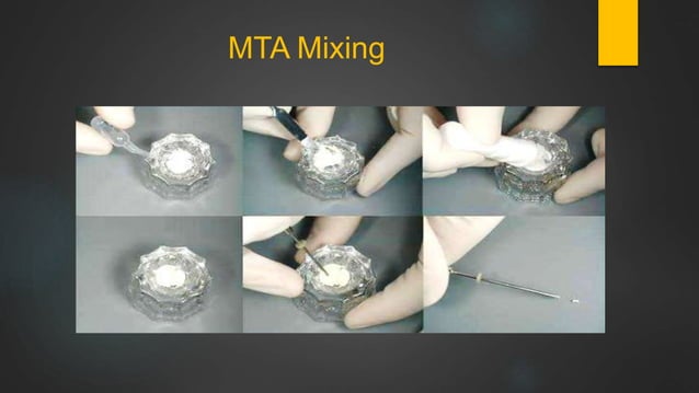 MTA ( Mineral Trioxide Aggregate ) | PPTX