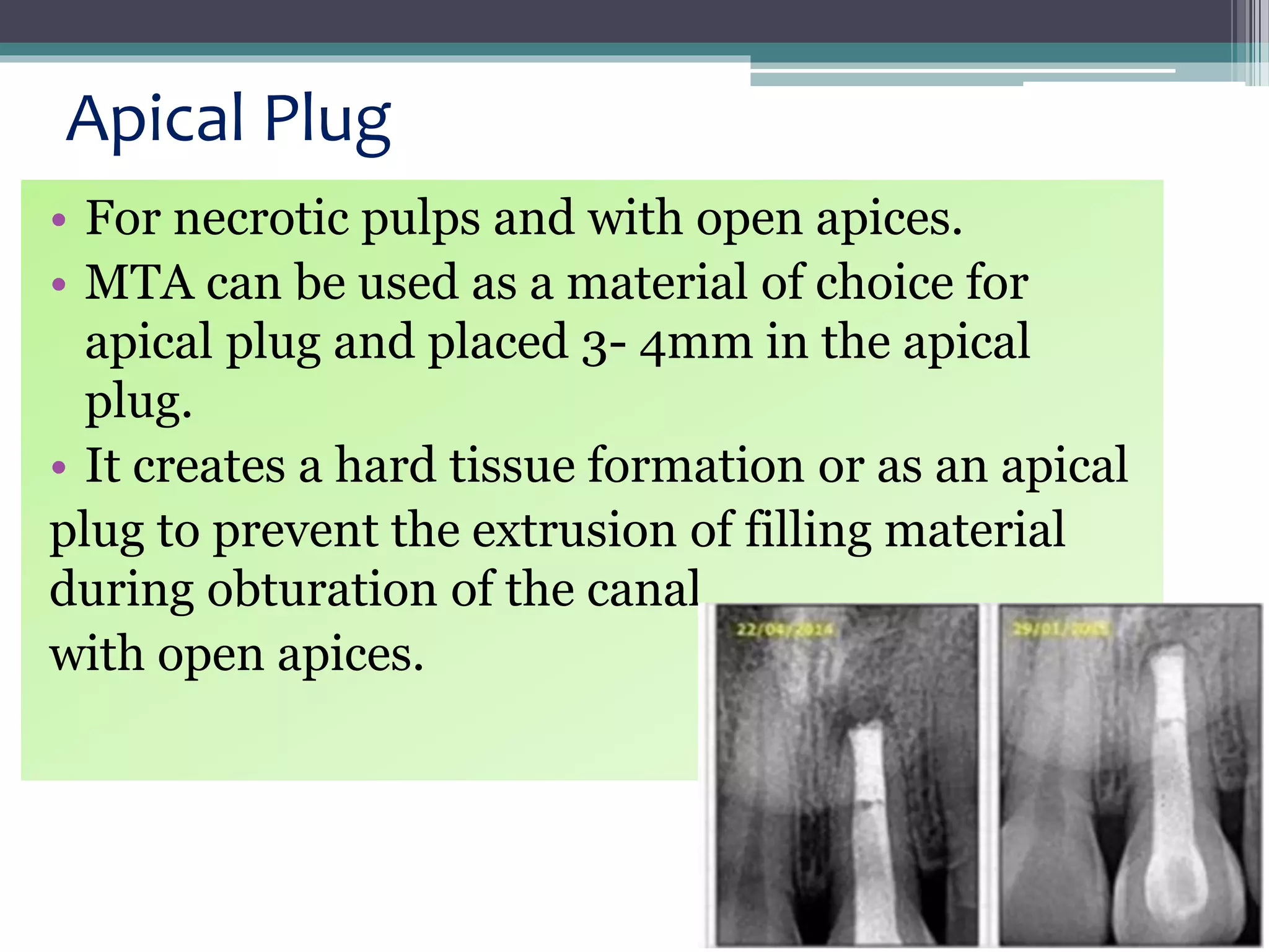 MTA & Biodentine | PPTX