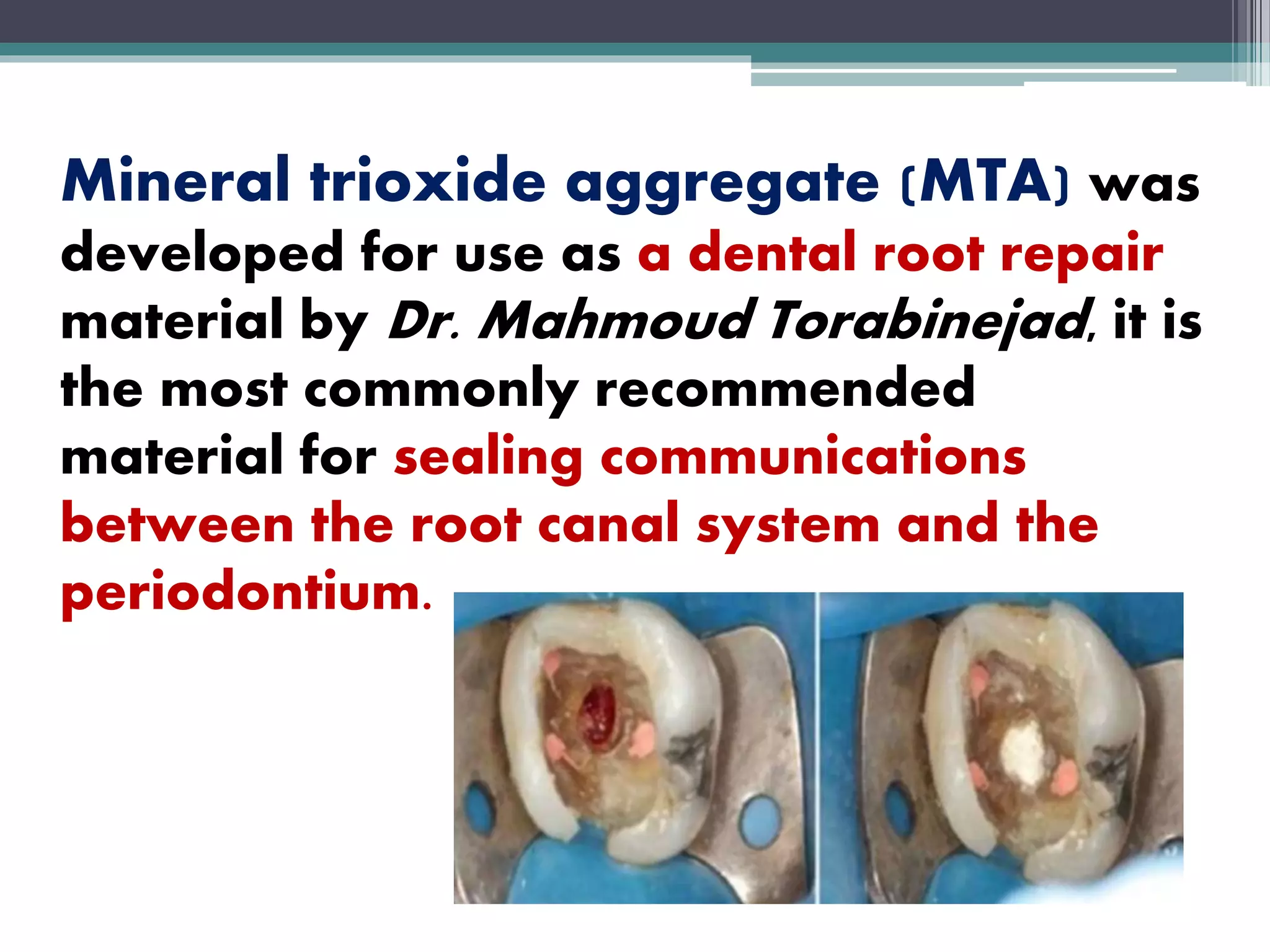 MTA & Biodentine | PPTX