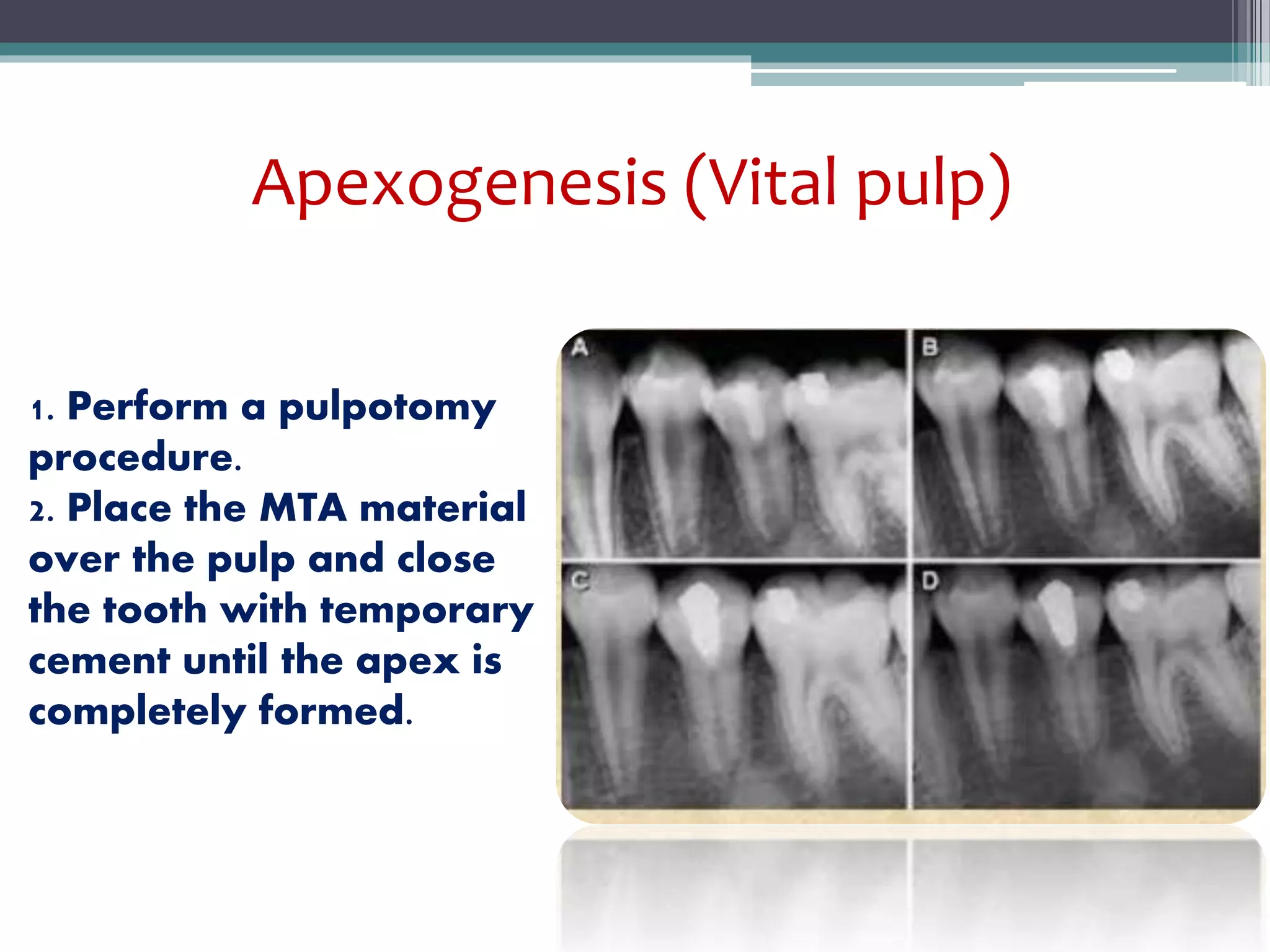 MTA & Biodentine | PPTX
