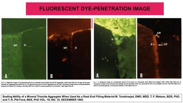 SEALING ABILITY OF MTA FOR REPAIR OF LATERAL ROOT PERFORATION | PPTX