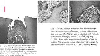 SEALING ABILITY OF MTA FOR REPAIR OF LATERAL ROOT PERFORATION | PPTX