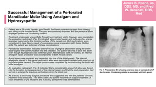SEALING ABILITY OF MTA FOR REPAIR OF LATERAL ROOT PERFORATION | PPTX