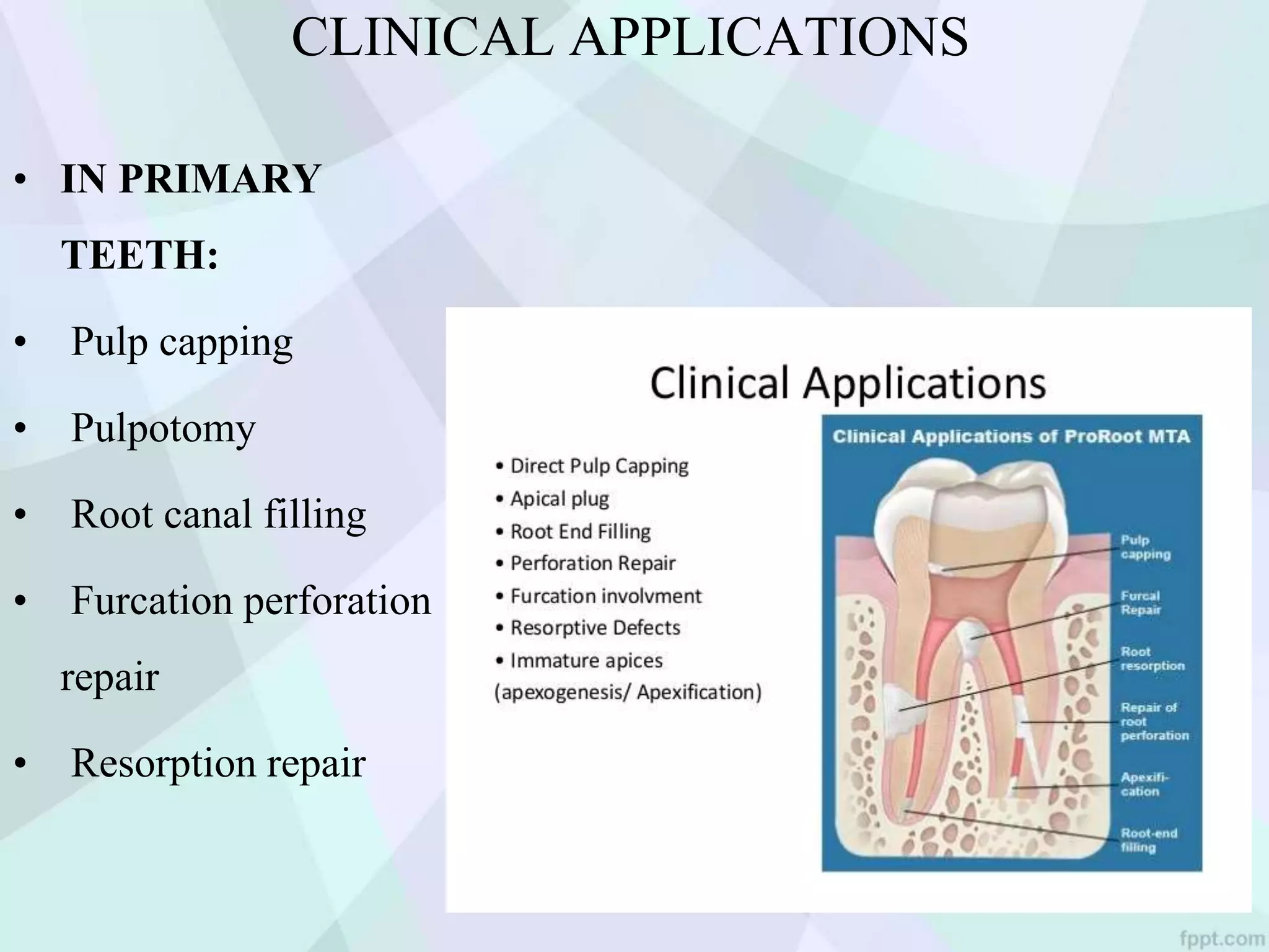 Mineral Trioxide Aggregate vs. Biodentine | PPTX