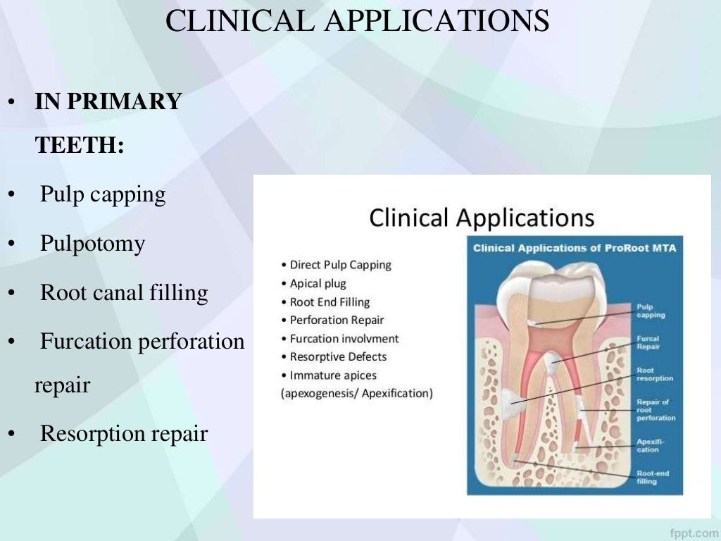 Mineral Trioxide Aggregate vs. Biodentine