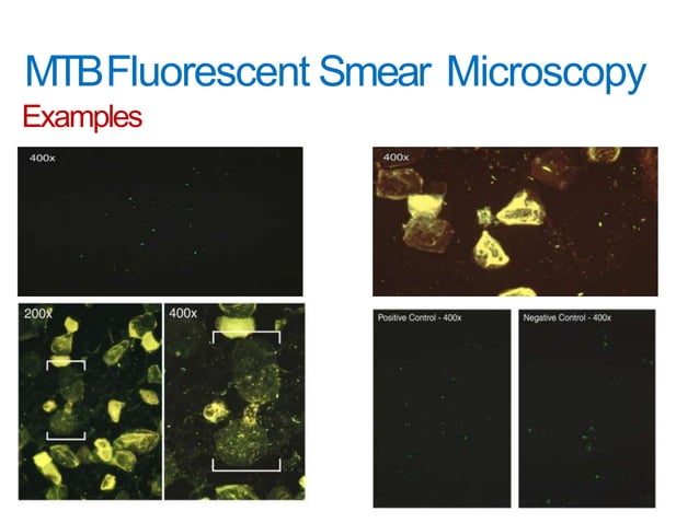 Mycobacterium tuberculosis smear microscopy | PPTX | Infectious ...